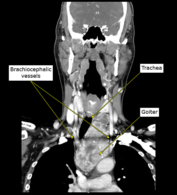 EL RINCÓN DE LA MEDICINA INTERNA. juanpedromacaluso@yahoo.com.ar ...