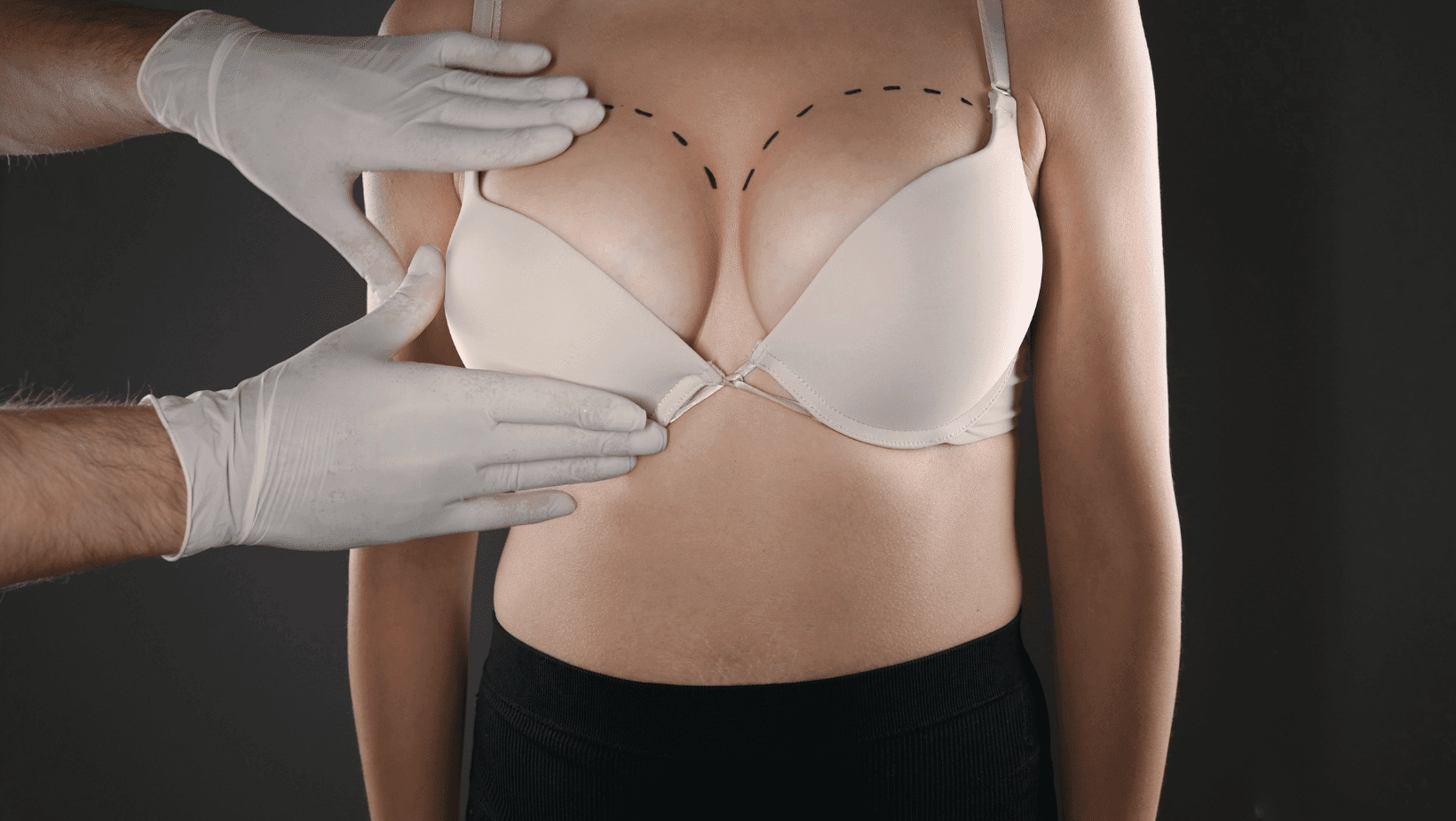 10 Most Popular Questions About Breast Implants Barbie s Beauty Bits 10-most-popular-questions-about-breast-implants-barbie-s-beauty-bits