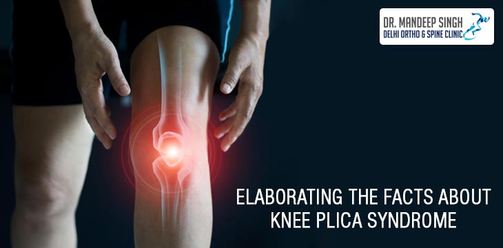 Elaborating The Facts About Knee Plica Syndrome