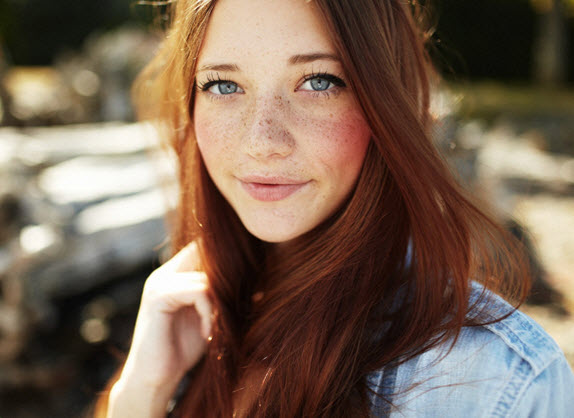 s What Are Freckles & Who Can get them? What causes Freckles? | SUPER ...