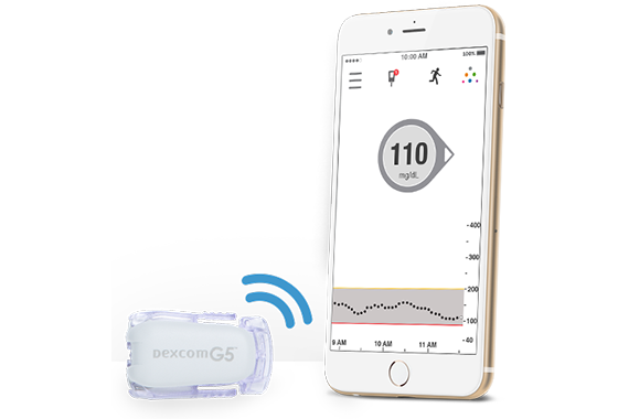 DIABETE TIPO 1: CGM Dexcom G5 Mobile – Acompanhe em tempo real sua ...
