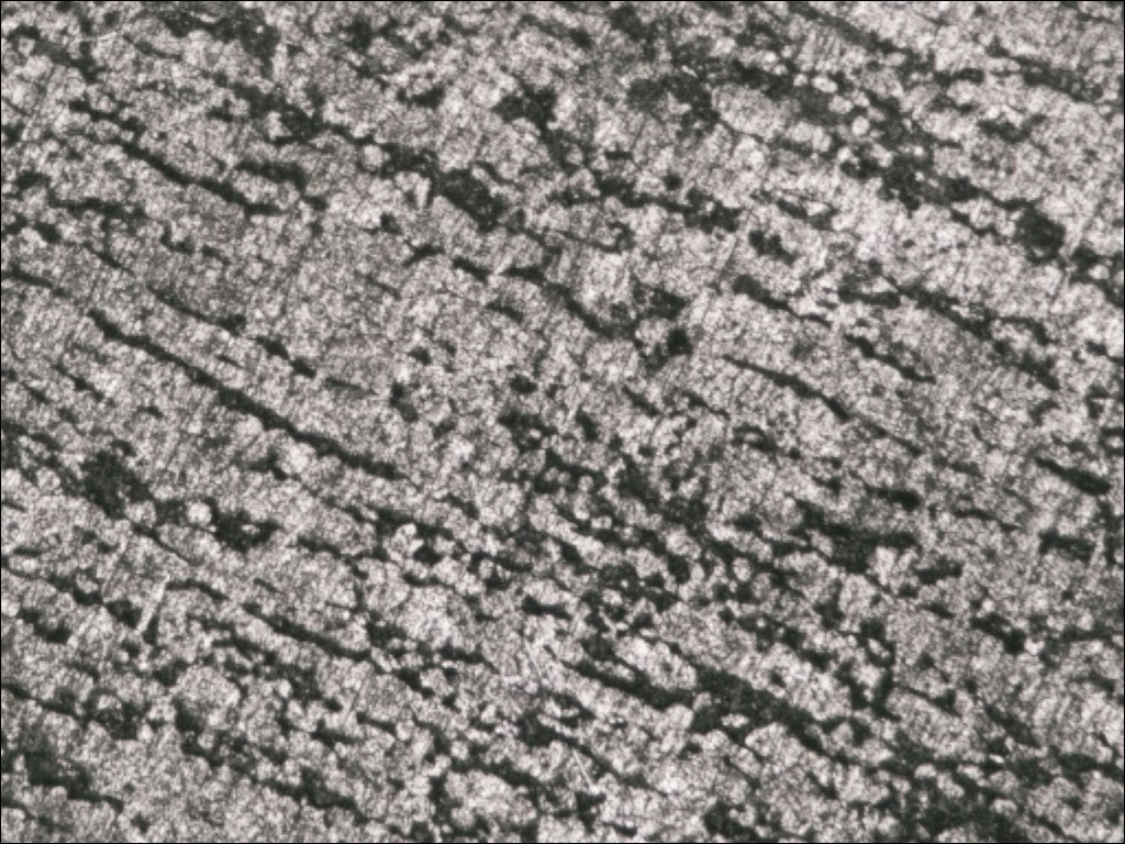 mech technobeat: Microstructures of Non ferrous Alloys