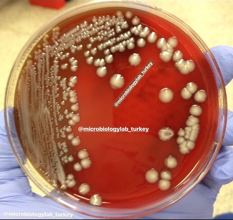 KLEBSIELLA SPP. - Microbiology Laboratory Turkey