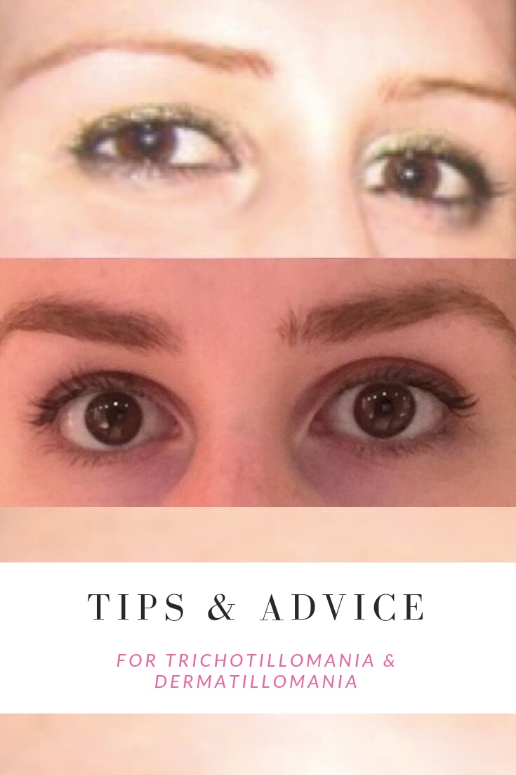 Tips & Advice for Trich and Derma | Cara Ward
