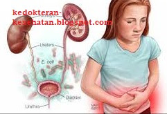 Penyebab Infeksi Saluran Kemih Pada Pria, Wanita, Bayi dan Anak, Serta Ibu Hamil - KLIK INSTAL