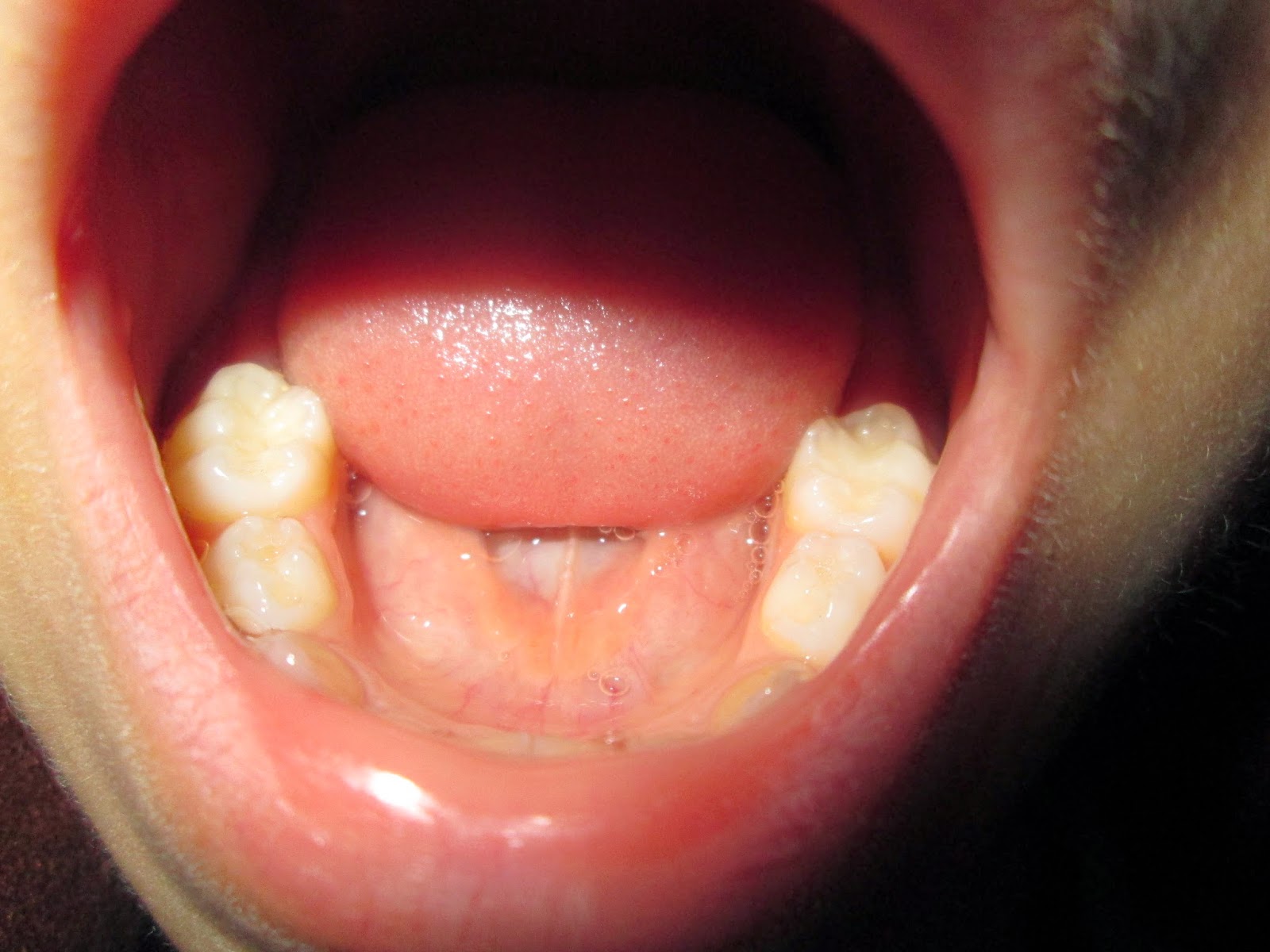 Your World: Healthy and Natural: Best 3 Tips to Keeping Teeth Healthy