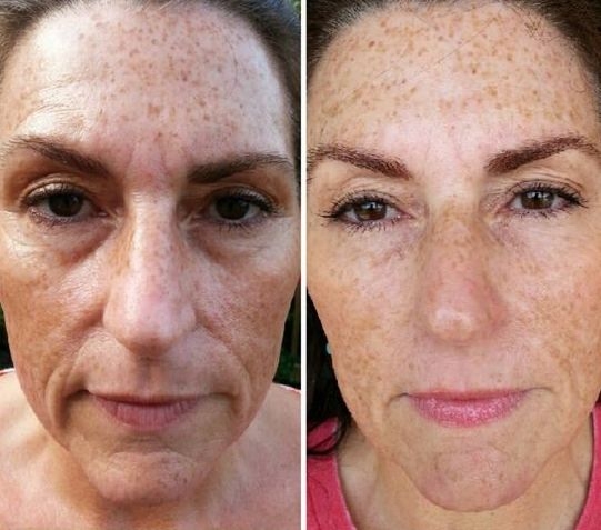 Strengthen Face Skin And Jowls Using Facial Aerobics: Sculpture, Raise ...