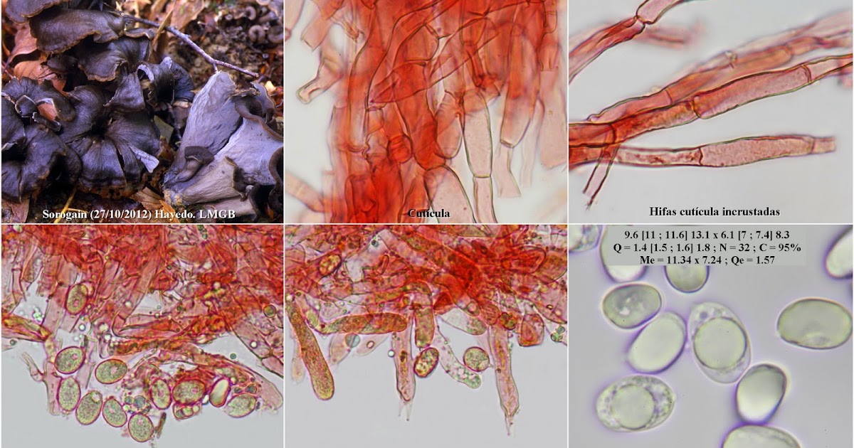 Microscopía de hongos. Vol 1 . A - C: Craterellus cornucopioides