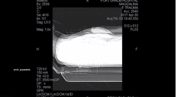 Koude Kaas - Cold Case: The mysterious death of Magdalena Żuk