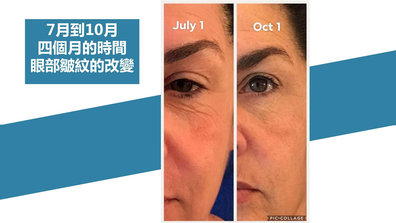 Somaderm HGH Gel - HK