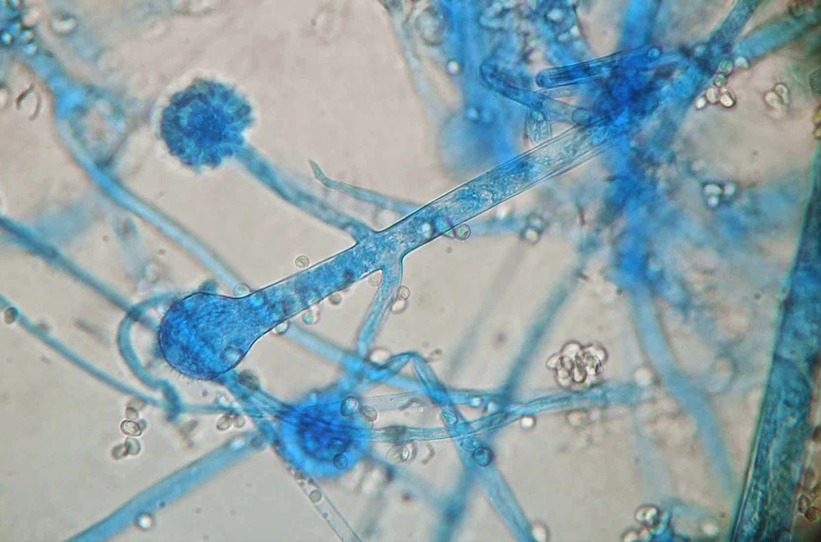 ATLAS MICOLOGIA: CUNNINGHAMELLA BERTHOLLETIAE