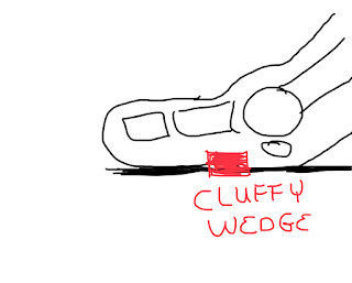 Foot and Ankle Problems By Dr. Richard Blake: Cluffy Wedge and Dancer's ...