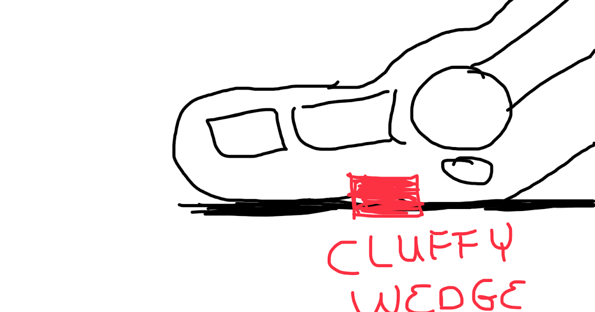 Foot and Ankle Problems By Dr. Richard Blake: Cluffy Wedge and Dancer's ...