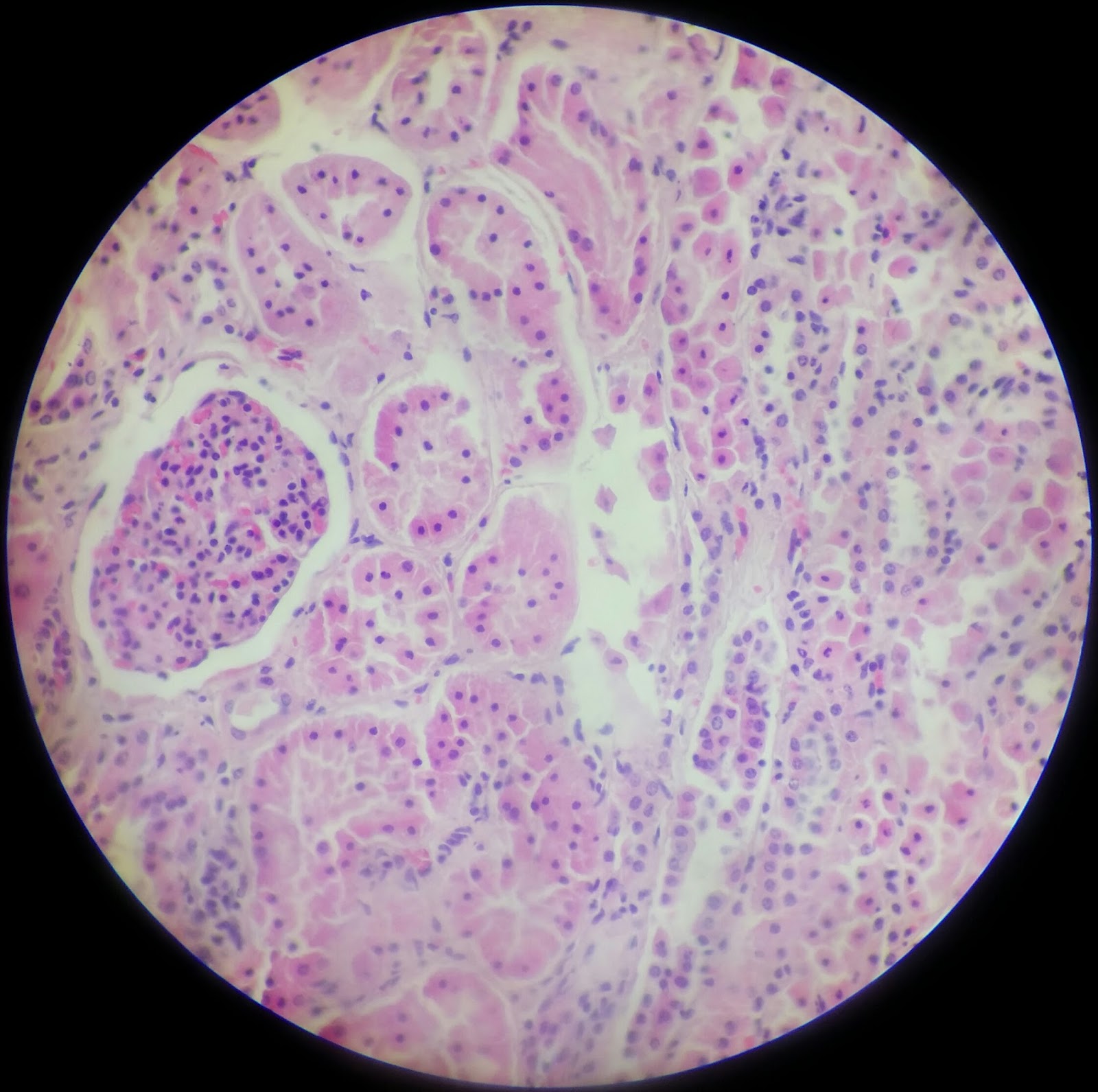 PROCESAMIENTO HISTOLÓGICO.: PROTOCOLO DE TINCIONES I HEMATOXILINA EOSINA.