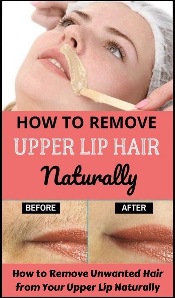 How To Remove Unwanted Hair From Your Upper Lip Naturally HealthMgz how-to-remove-unwanted-hair-from-your-upper-lip-naturally-healthmgz