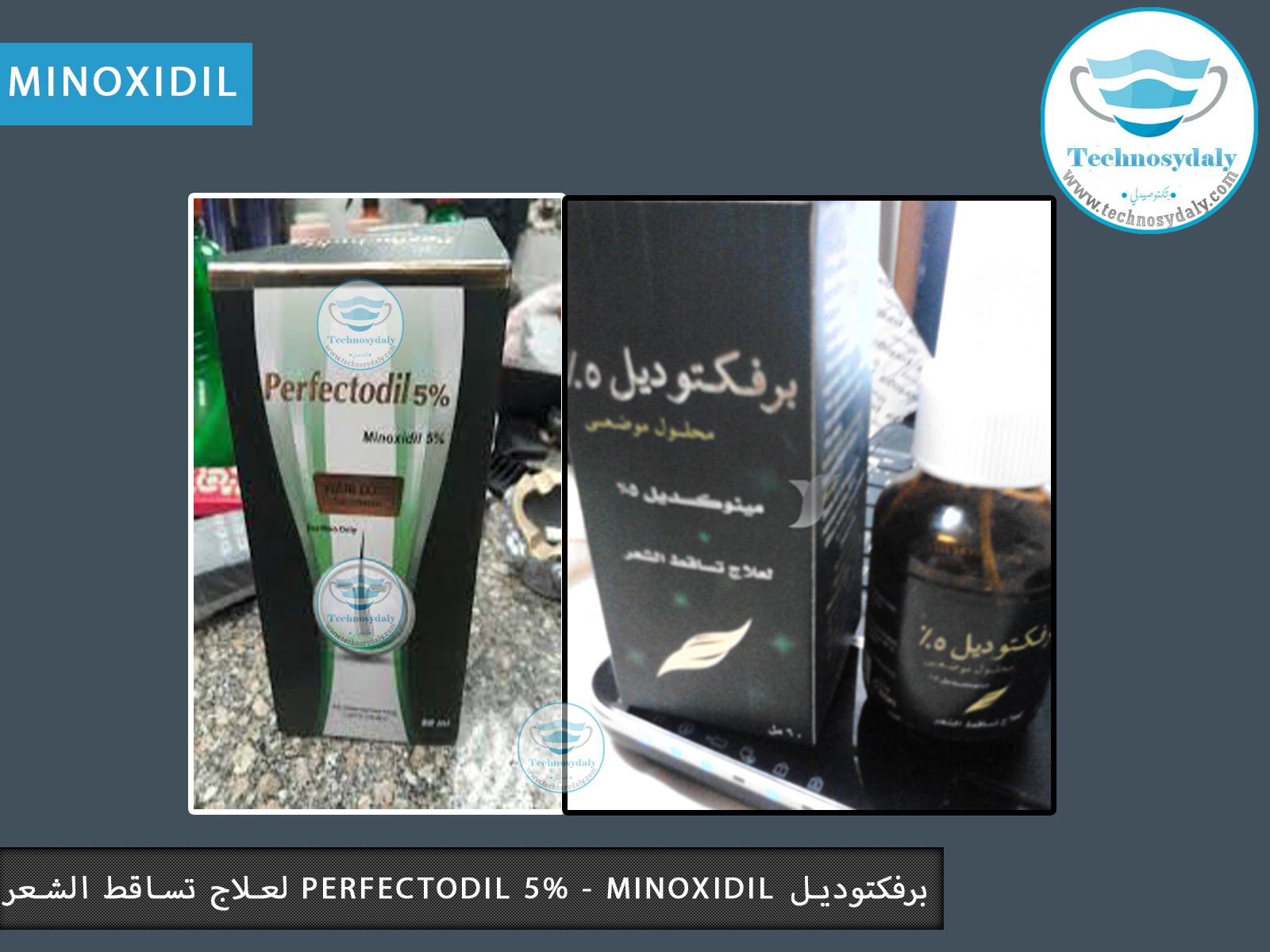 برفكتوديل perfectodil 5% | لعلاج تساقط الشعر والصلع المبكر