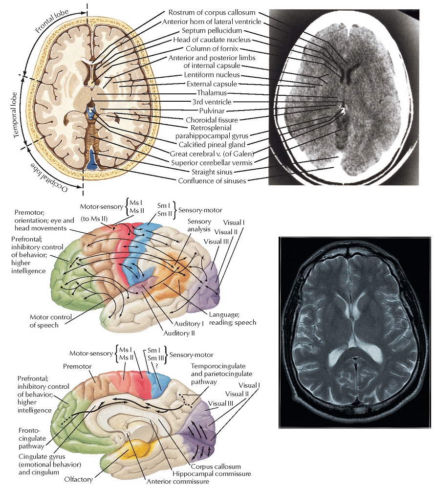 Functional Correlations and Visualization of Brain Structures ...