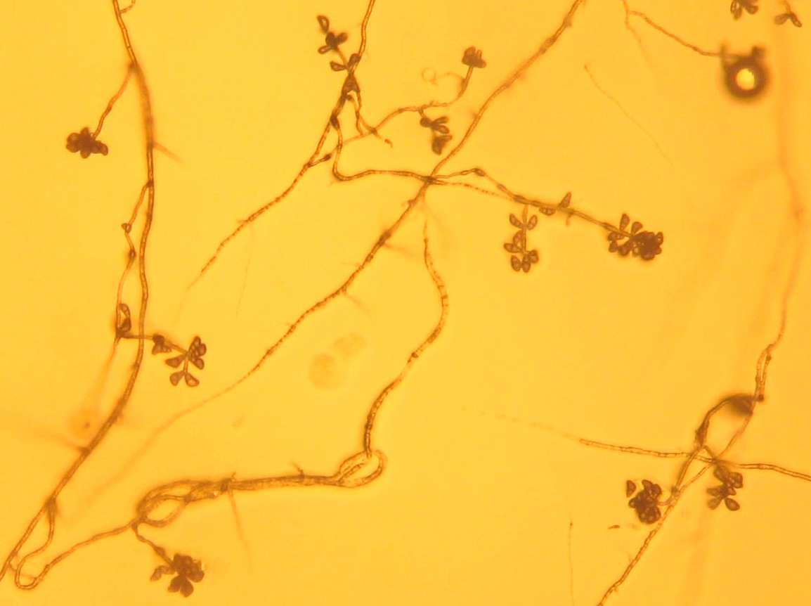 TAMU_PLPA631_FungalBlog_LornaNissen: Unknown I and II