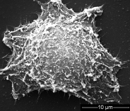 Breakthrough in loading gold nanorods into cells could lead to new ...