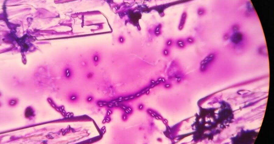 microbiologia2017: Tinción de Hiss.