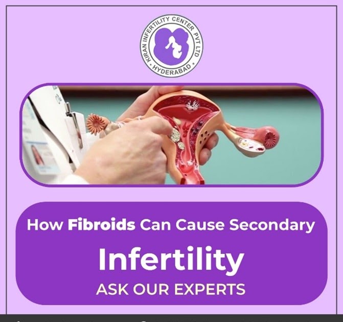 Fibroids And Infertility ~ The Surrogacy Doctor Dr Samit Sekhar