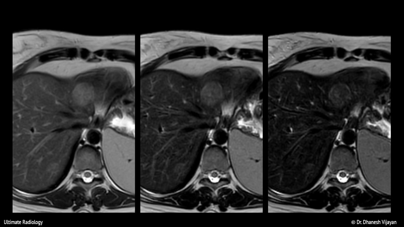 Ultimate Radiology : 2020