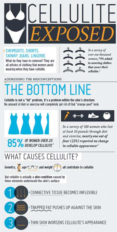 Quick Ways to Get Rid of Cellulite