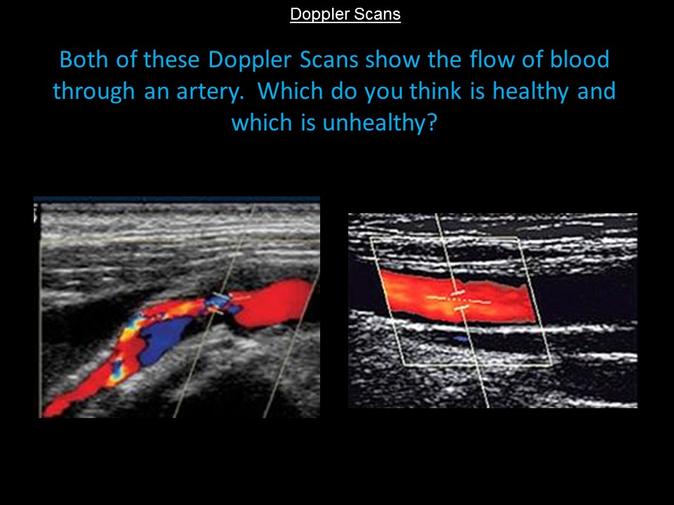 Mr Lloyd's Interactive Board: Doppler Effect, ultrasound, medical imaging