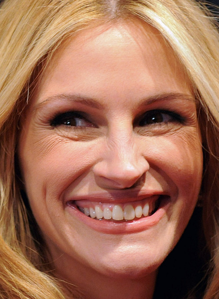 Julia roberts plastic surgery | World Celebrity