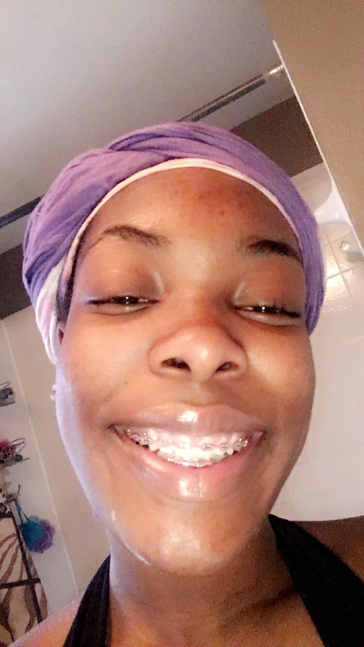 Photos: US-based Nigerian lady with deformed teeth shows off the ...