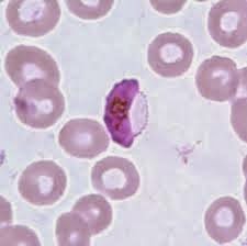 Fichero de Hematología : PARÁSITOS SANGUÍNEOS