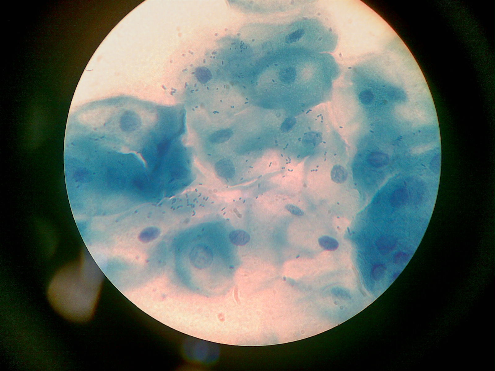 Leucoblog: Visualización de células epiteliales de la mucosa bucal.