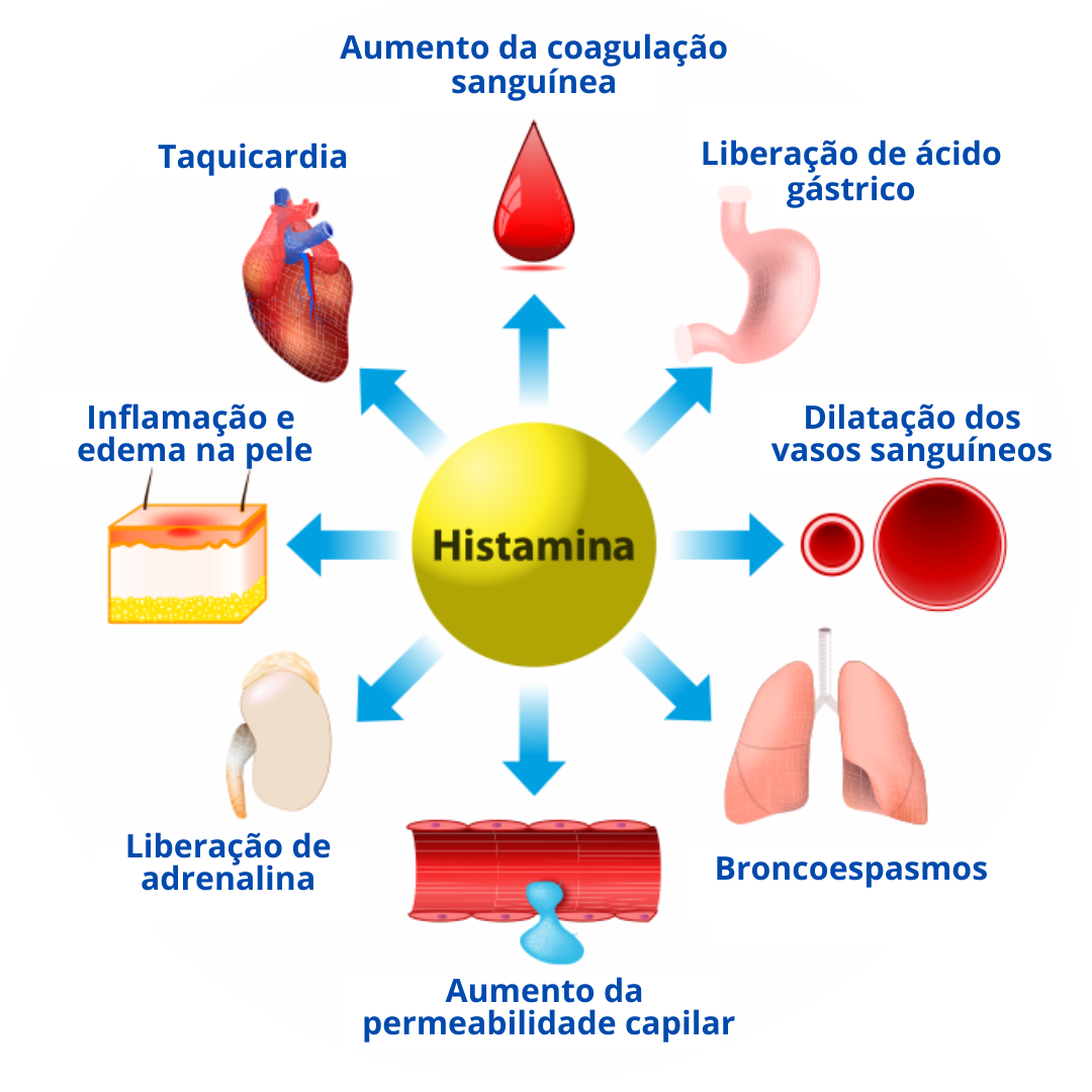 Sintomas Excesso De Histamina No Organismo