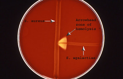 CAMP TEST - Microbiology Lab Notes