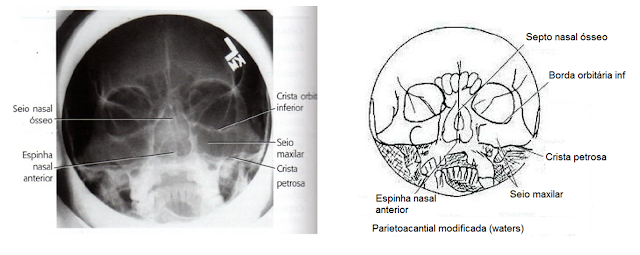 Laboratório de Roentgen: Crânio e Face