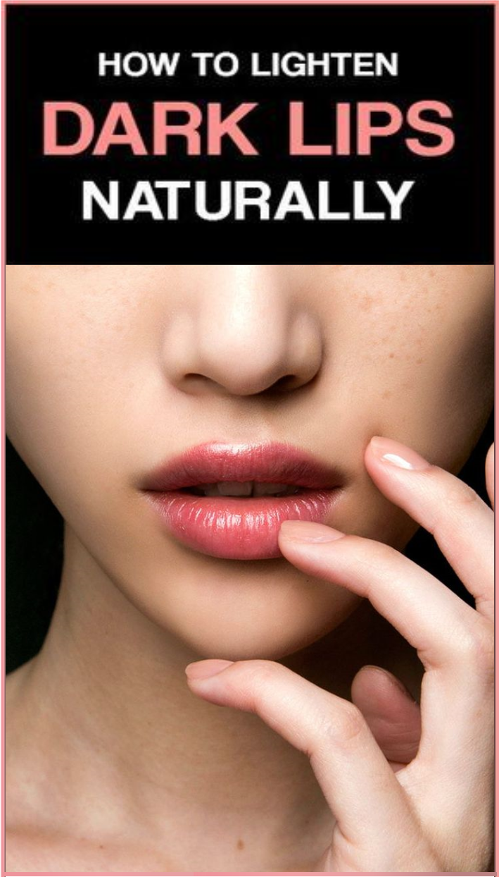 Here Are Some Simple Home Remedies To Remove Darkness Around Lips here-are-some-simple-home-remedies-to-remove-darkness-around-lips