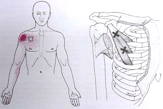 KO Performance: Addressing Tension and Tissue Quality - Part 2