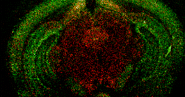 News in Proteomics Research: AP-MALDI animal brain imaging on a Q Exactive!