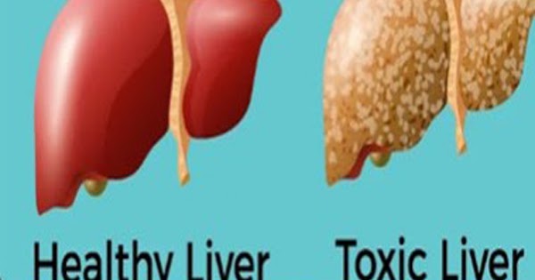 6 Clear Warning Signs Your Liver Is Full Of Toxins And Making You Fat ...