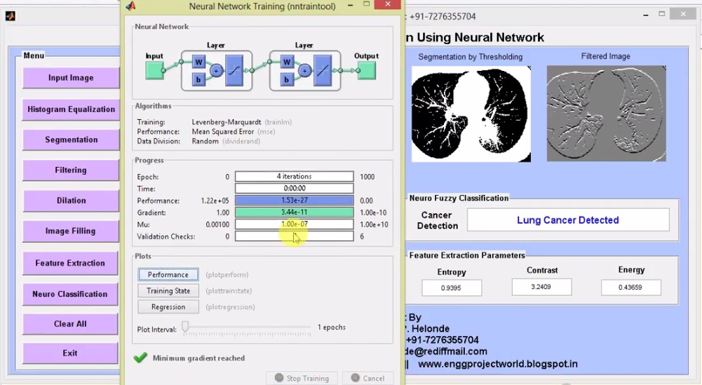 Matlab Project Lung Cancer Detection Using Neural Network Full Source Code || IEEE Based Project ...
