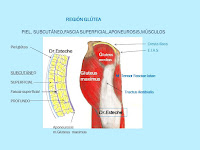 Dr. Esteche | Cirugía Plástica de Glúteos | Buttocks surgery: REGION ...