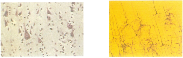 Med Questões: Neurônios e Glia (Bear - Cap. 2)