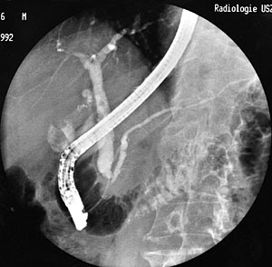 El Blog de Ernesto: La cepre