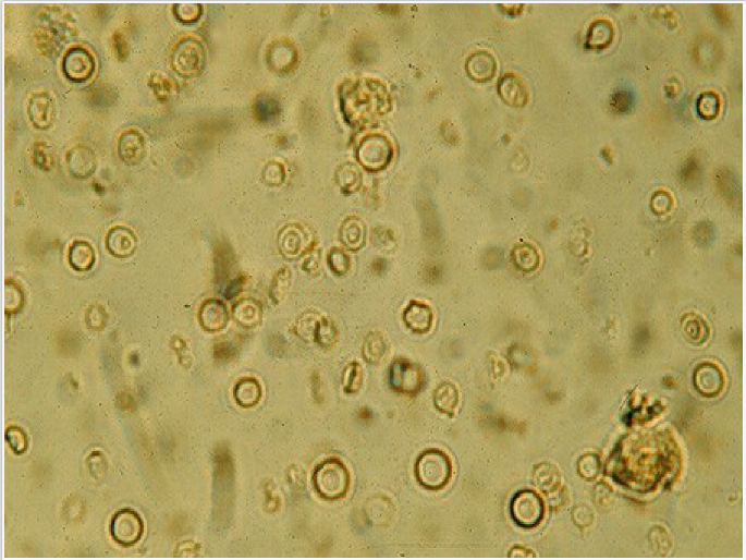 Algo de microbiología: Urocultivo:protocolo de rutina
