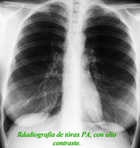 Medios de contraste radiologia - cjBos