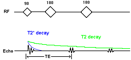 Basics of MRI ~ King's of Radiology