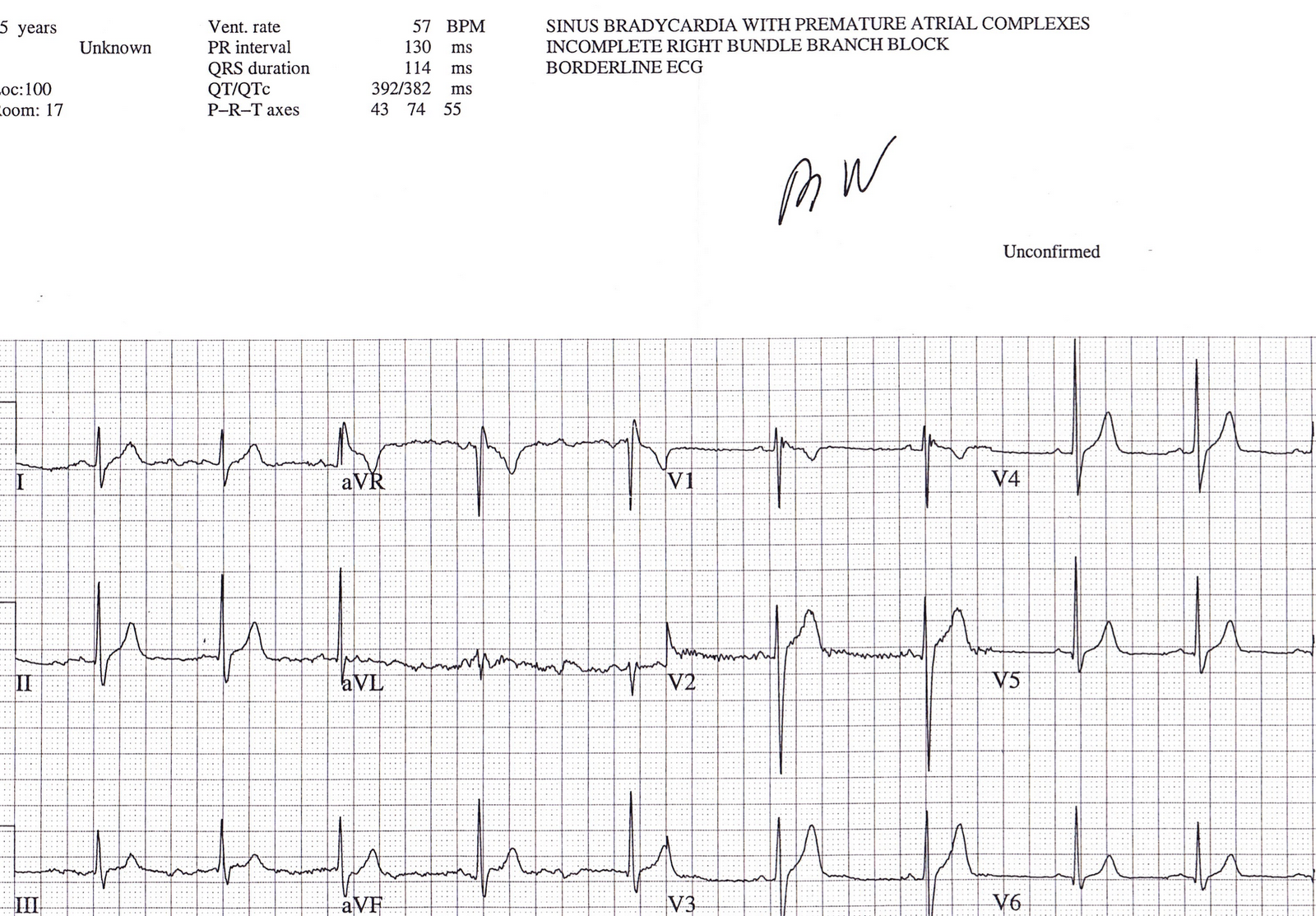 Mill Hill Ave Command: Why paramedics need to read EKGs... Part III ...