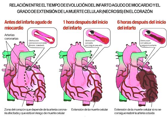 BLOGOCIOLOGICO: ATAQUE AL CORAZÓN