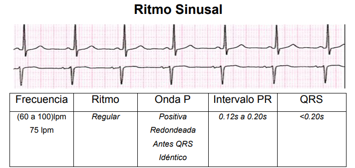 ELECTROCARDIOGRAFÍA BÁSICA PARA ENFERMERÍA: RITMO EN UN ELECTROCARDIOGRAMA