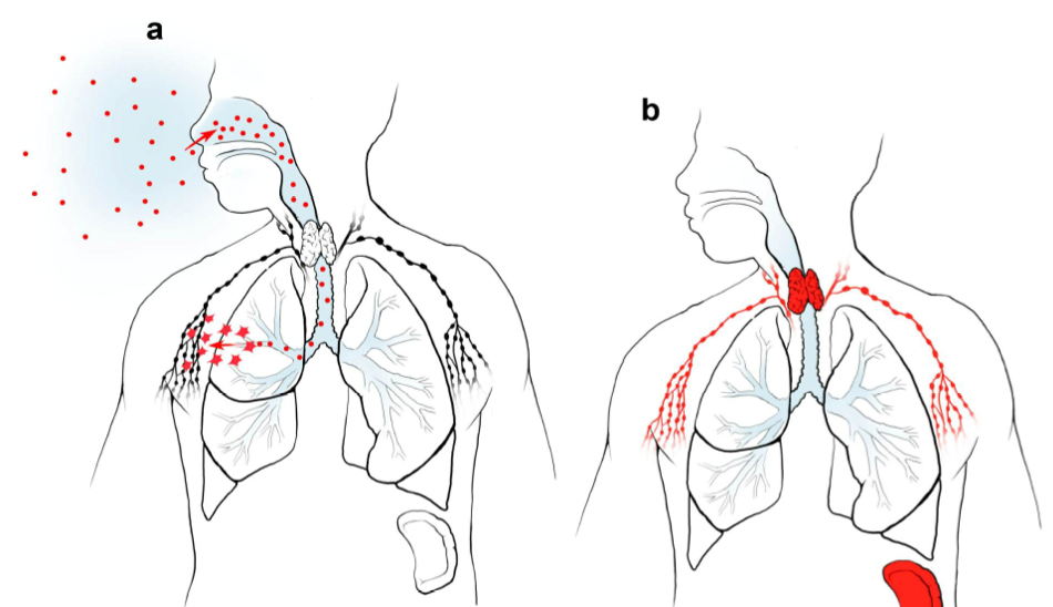 Rule of 6ix: Revisiting the origins of contagion - the measles story